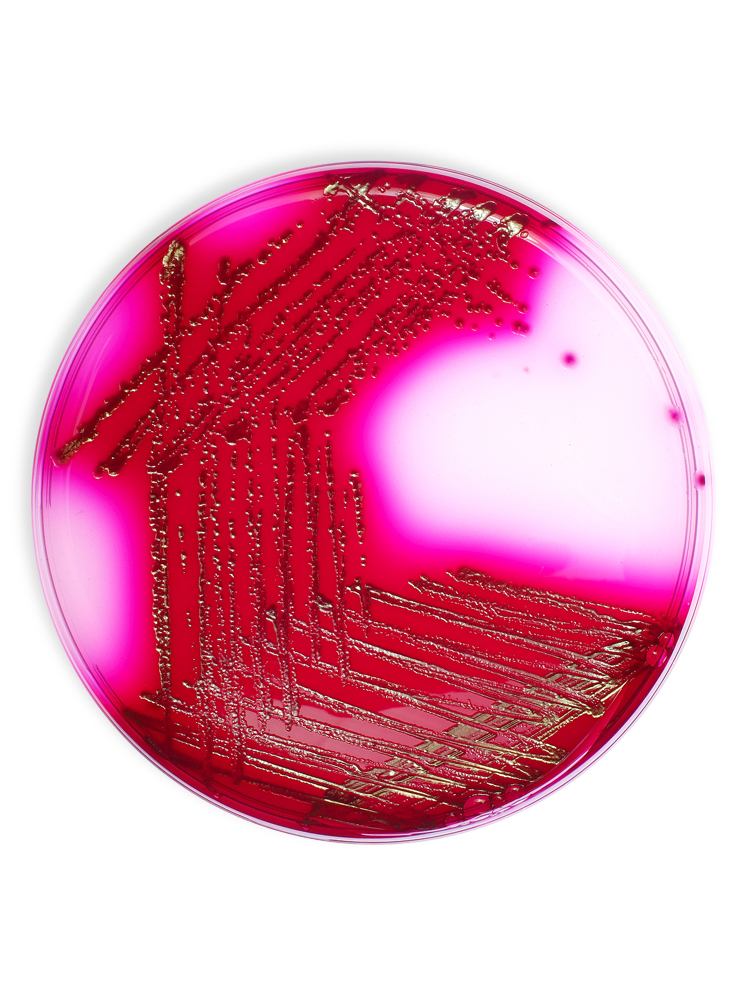 Endo agar (ENDO) | BioVendor LM