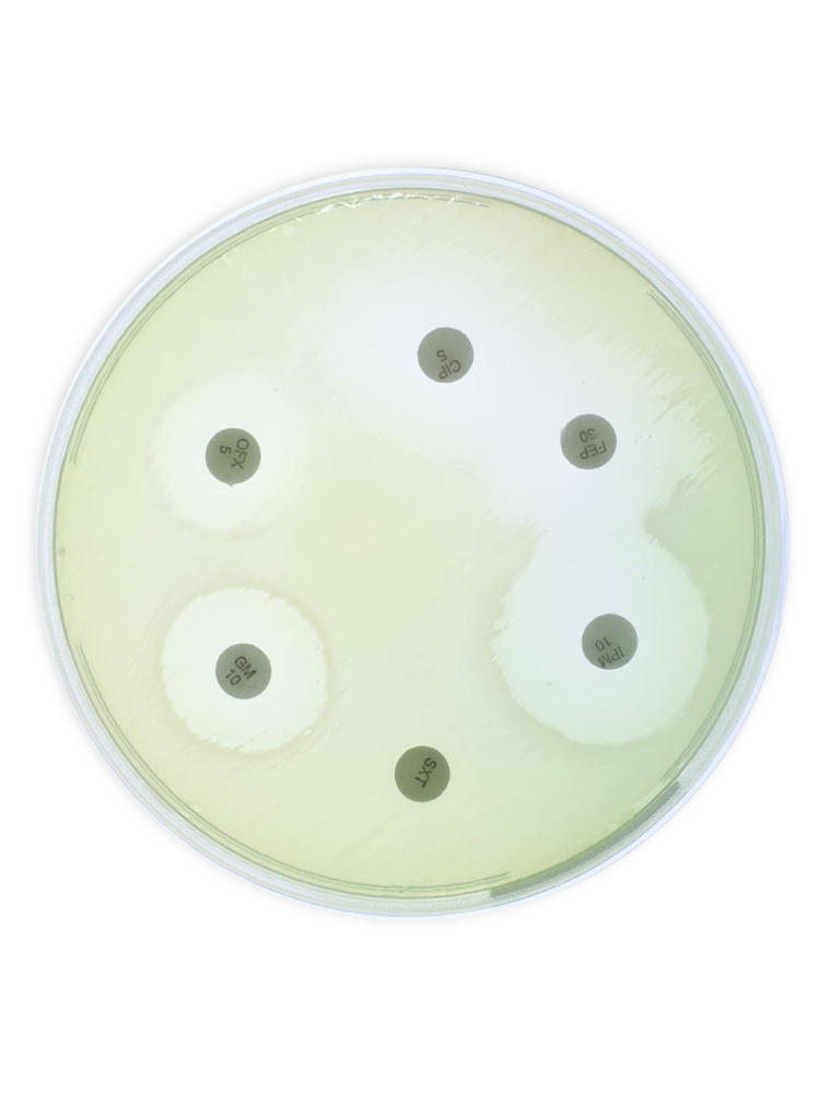 Mueller-Hinton agar (MH) | BioVendor LM