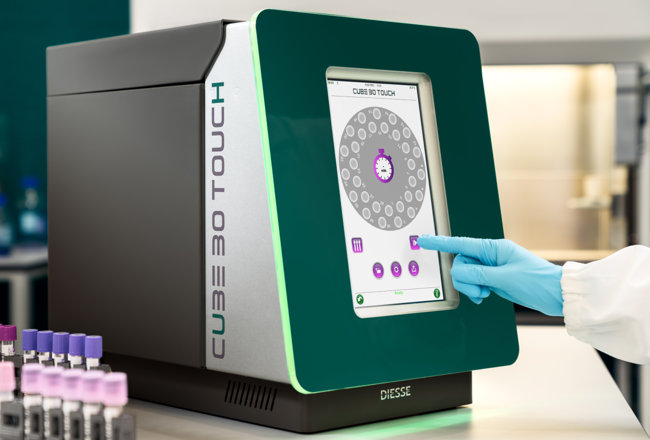 Automatizovaná sedimentace erytrocytů | BioVendor LM