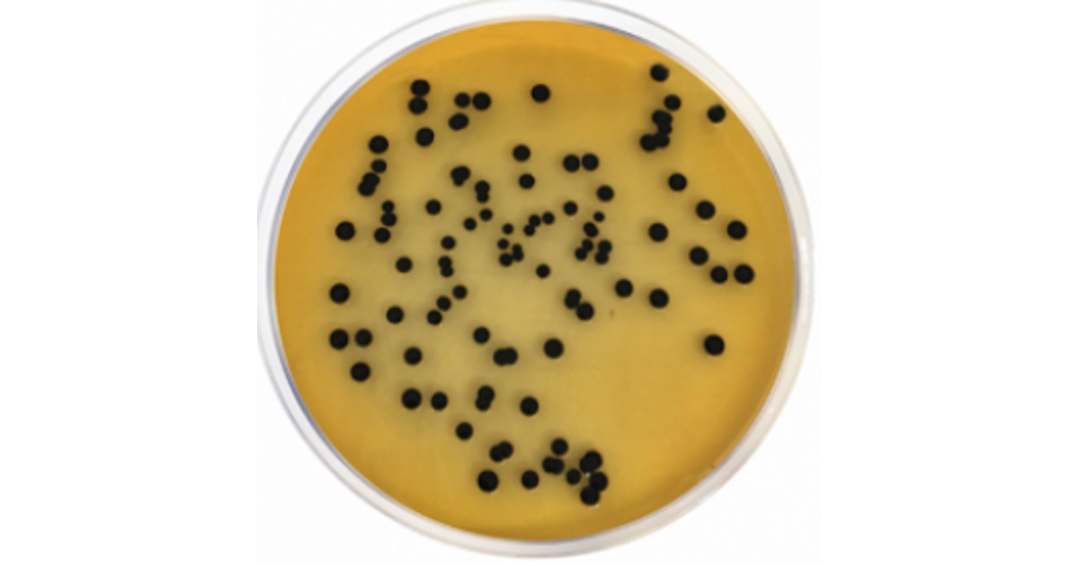 Salmonella Shigella Agar (SS) | BioVendor LM